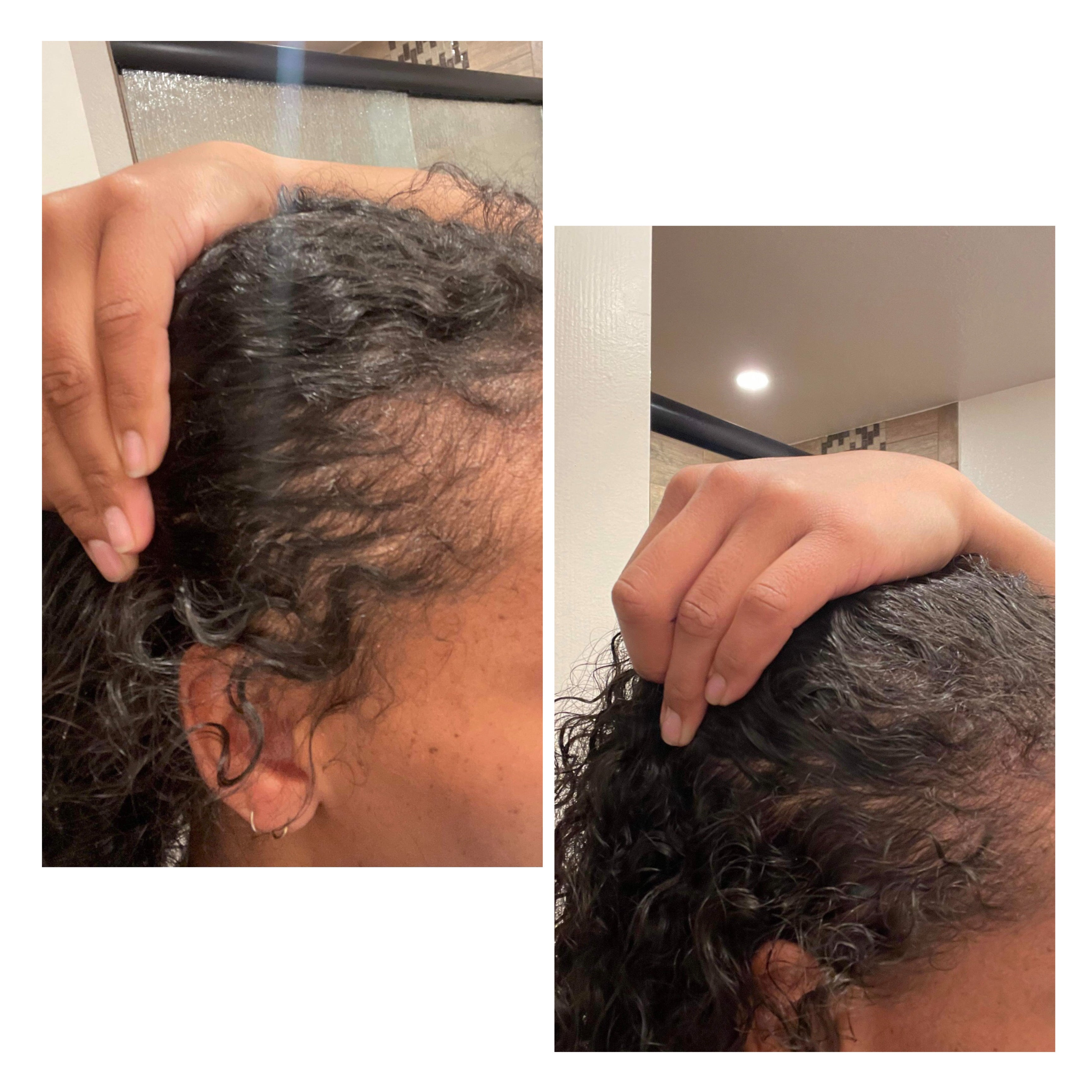 Alopecia Hair Growth Collection – Unique Organics Haircare and Skincare